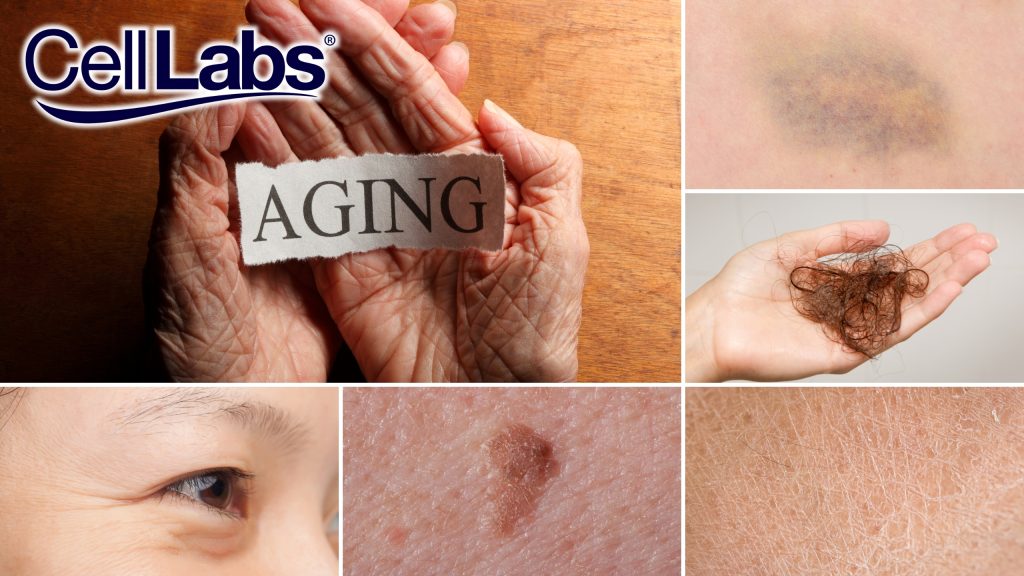 7 Signs of Premature Aging - CellLabs