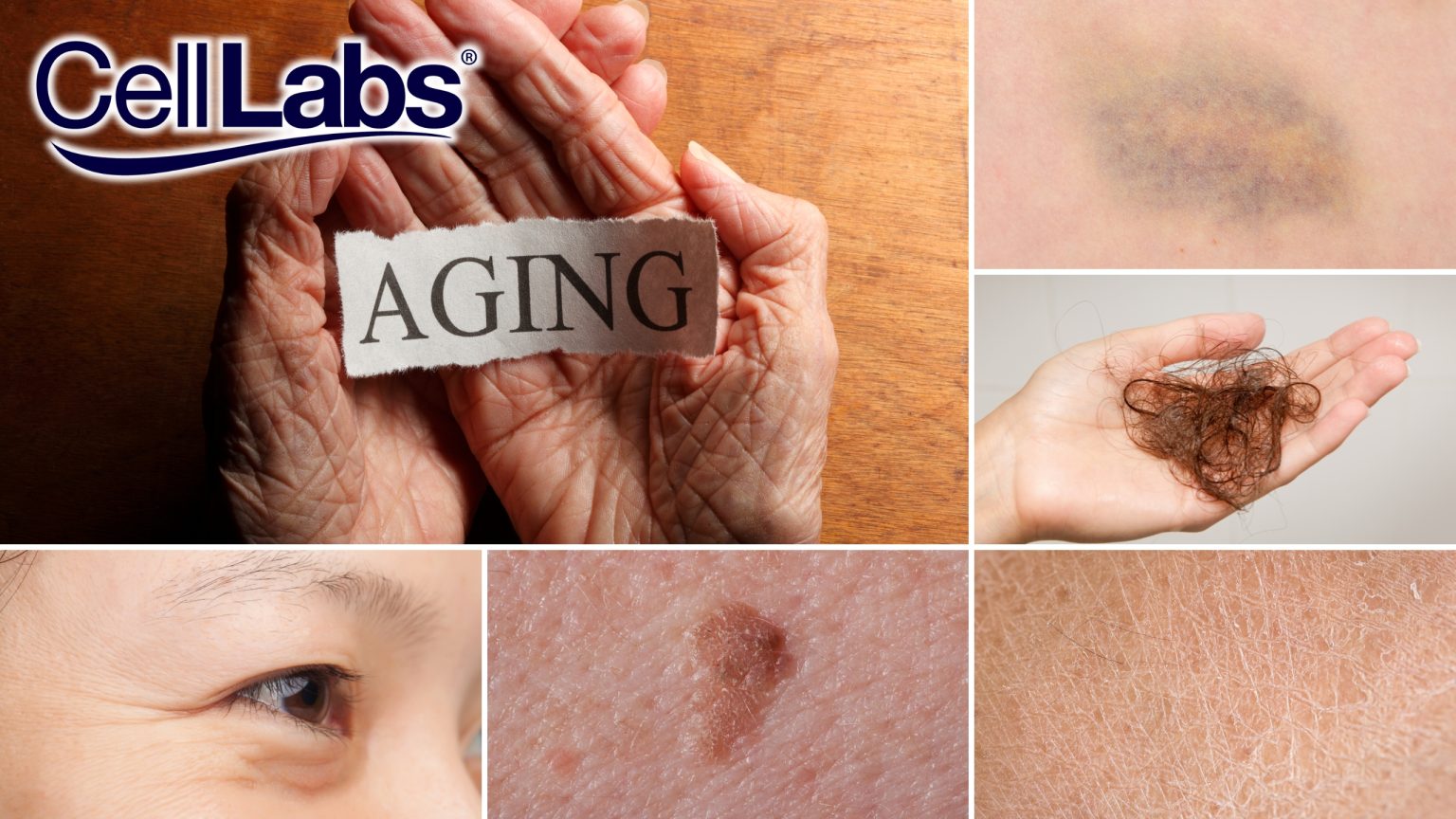 7 Signs of Premature Aging - CellLabs